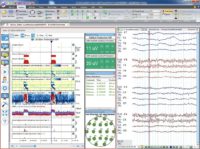 Cadwell easy eeg reader - lasopaultimate