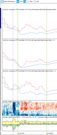 FAQs, Videos, and Quick Guides - Persyst