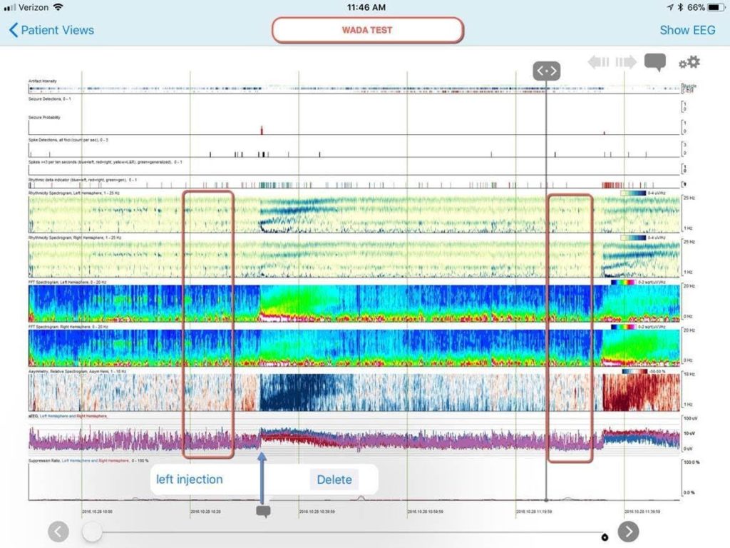 FAQs, Videos, and Quick Guides - Persyst