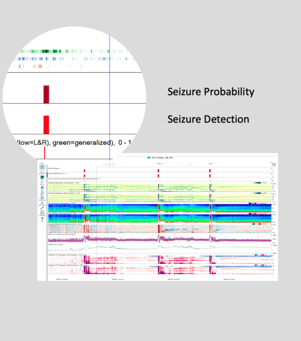 Seizure Detection - Persyst
