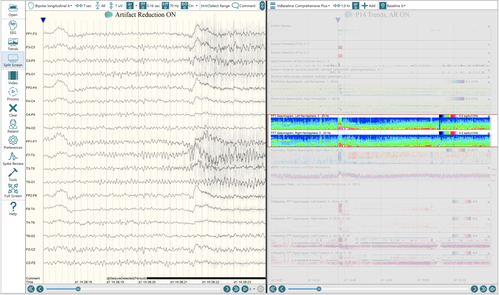 FFT Spectrogram - Persyst
