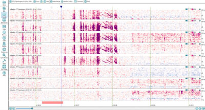 Persyst 15 - Persyst