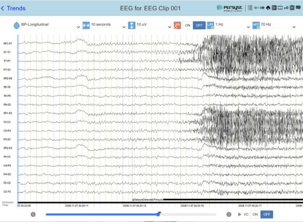 Persyst Mobile Cloud - Persyst