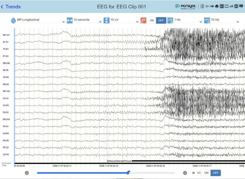 Persyst Mobile Cloud - Persyst