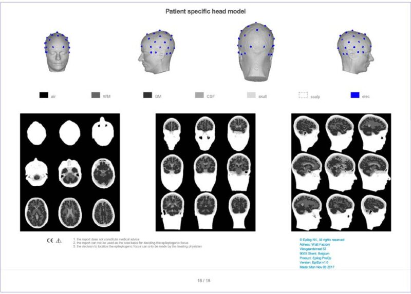 Persyst ESI powered by Epilog - Persyst