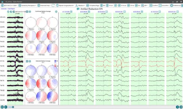Persyst 15 - Persyst